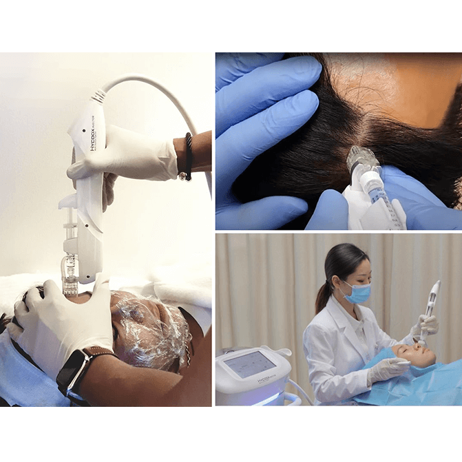 Hycoox injector machine for scalp injection and facial injection